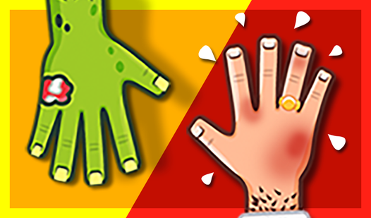 Extreme Hand Slap — play on 𝐏𝐥𝐚𝐲𝐠𝐚𝐦𝐚 (by RHM Interactive)